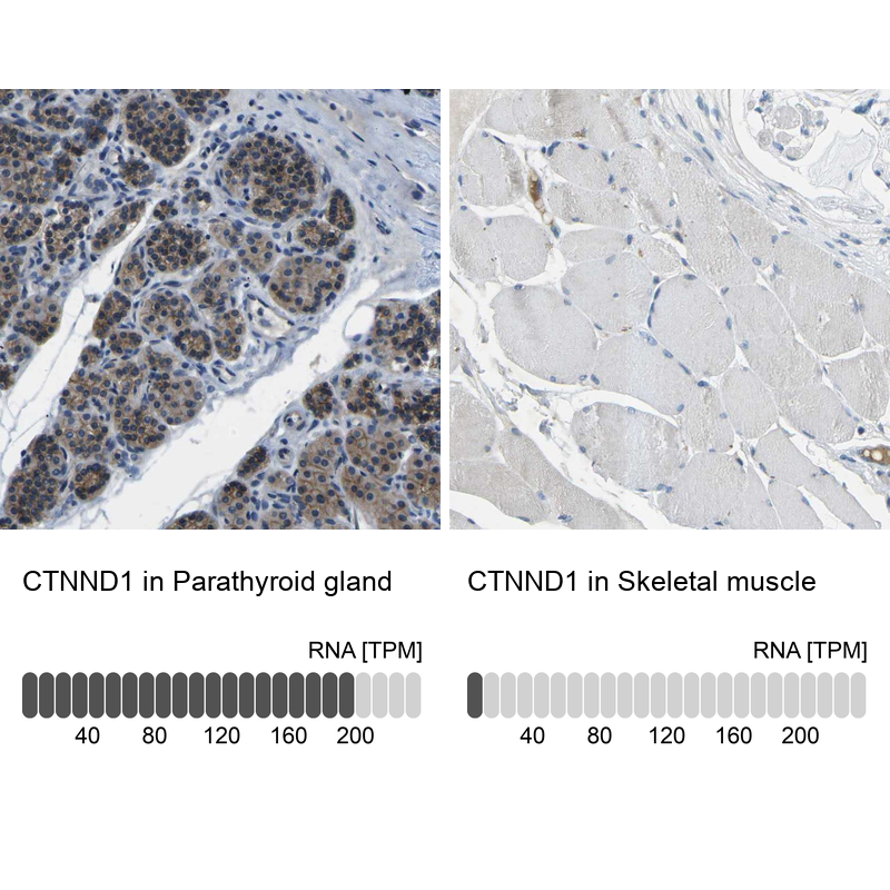Rabbit Polyclonal Anti-CTNND1 Antibody - Buy for research - Highly ...
