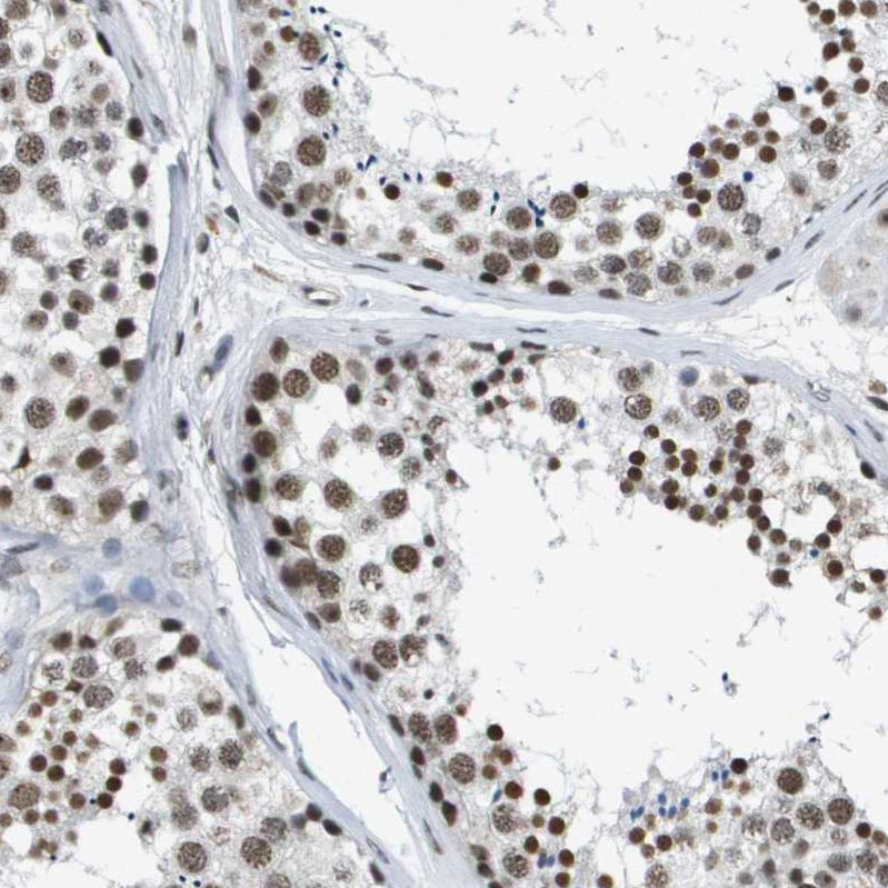 Rabbit Polyclonal Anti-EP400 Antibody - Buy for research - Highly ...