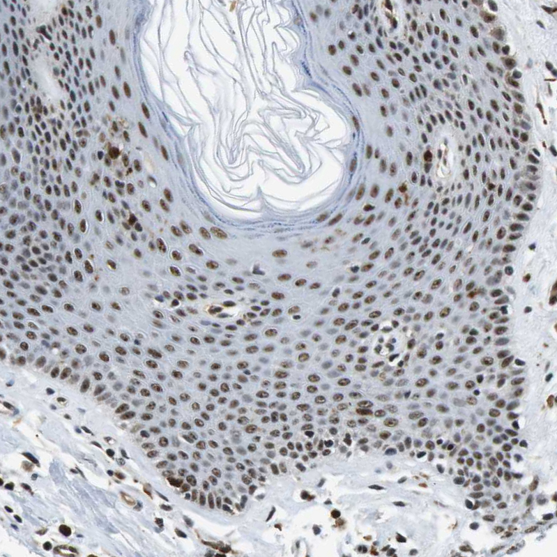 Rabbit Polyclonal Anti-EP400 Antibody - Buy for research - Highly ...