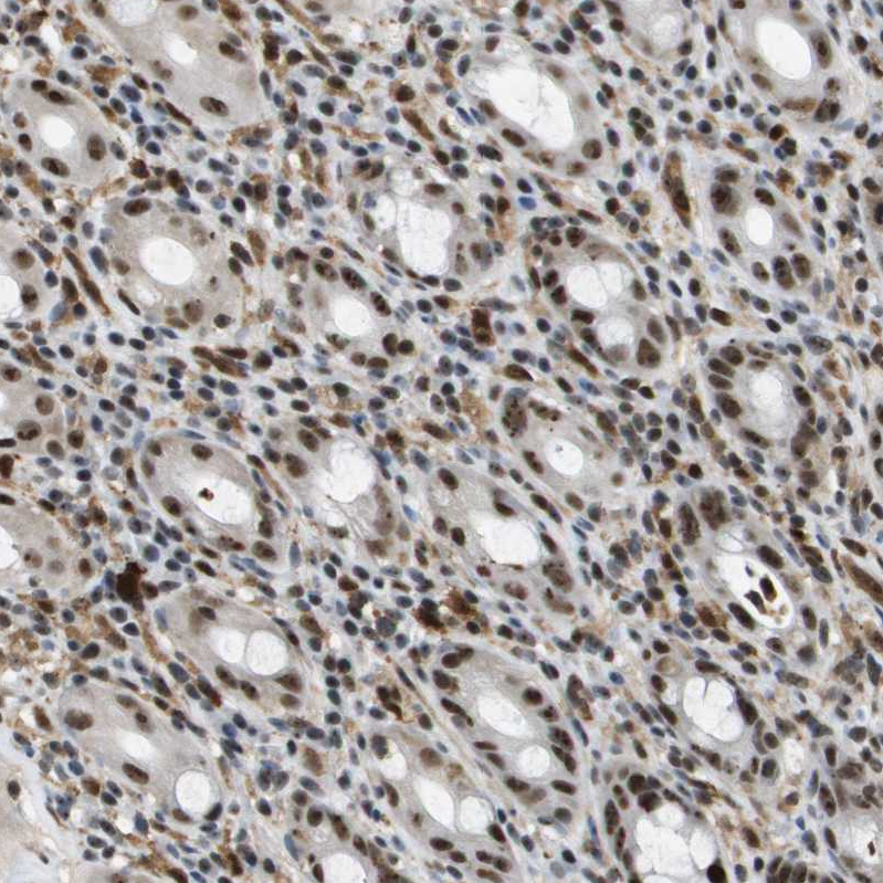 Rabbit Polyclonal Anti-EP400 Antibody - Buy for research - Highly ...