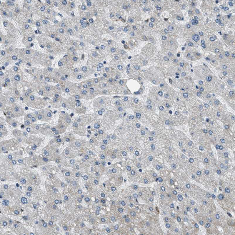 Rabbit Polyclonal Anti-SP100 Antibody - Buy for research - Highly ...