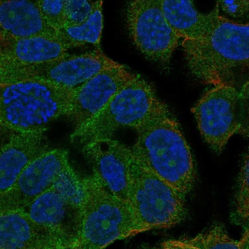 Rabbit Polyclonal Anti-CEMIP2 Antibody - Buy for research - Highly ...