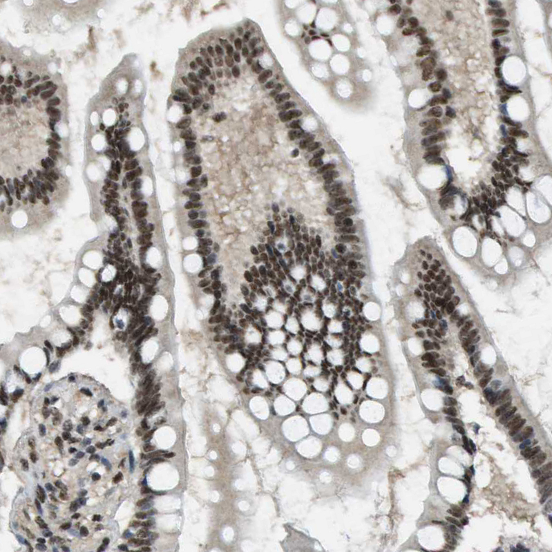 Rabbit Polyclonal Anti-SP100 Antibody - Buy for research - Highly ...