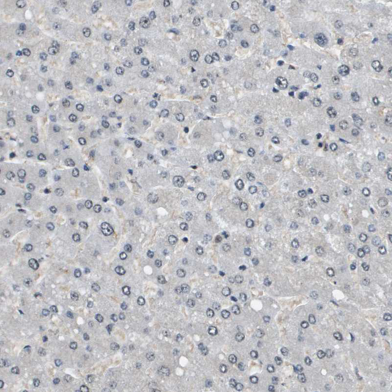 Rabbit Polyclonal Anti-SP100 Antibody - Buy for research - Highly ...