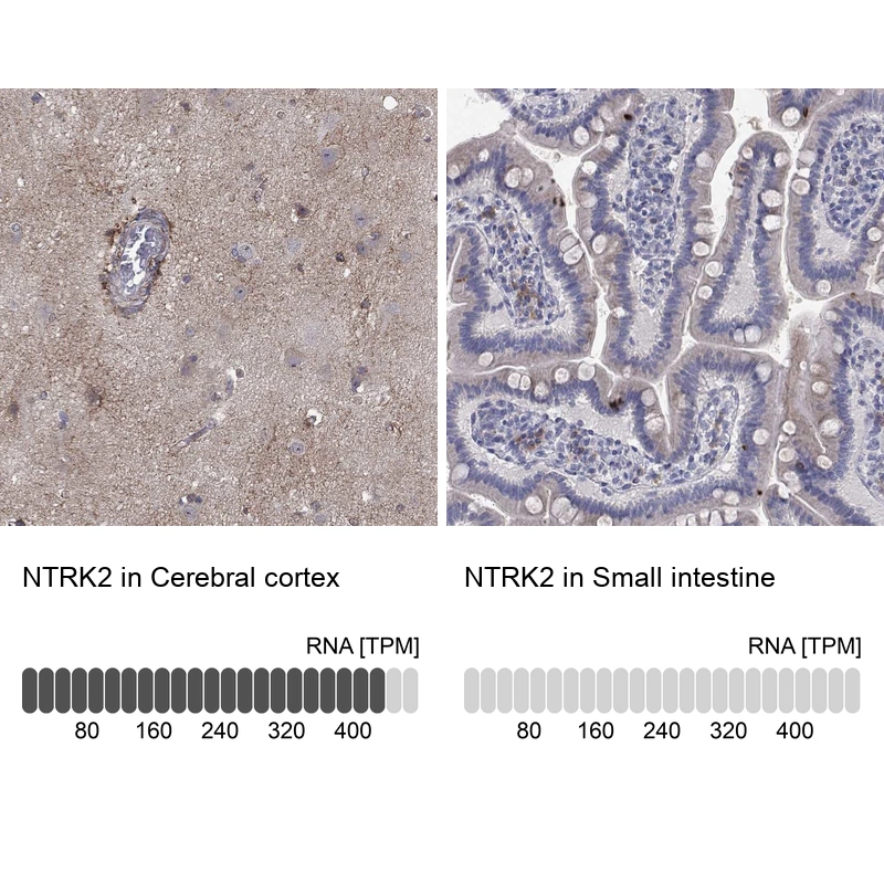 Rabbit Polyclonal Anti-NTRK2 Antibody - Buy for research - Highly ...