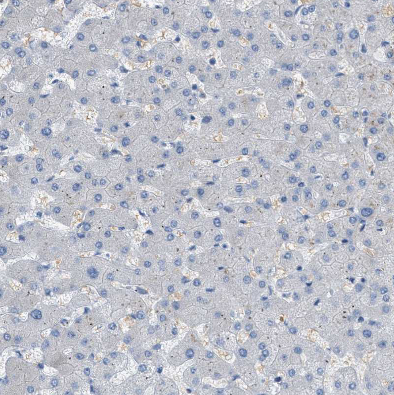 Rabbit Polyclonal Anti-MRS2 Antibody - Buy for research - Highly ...