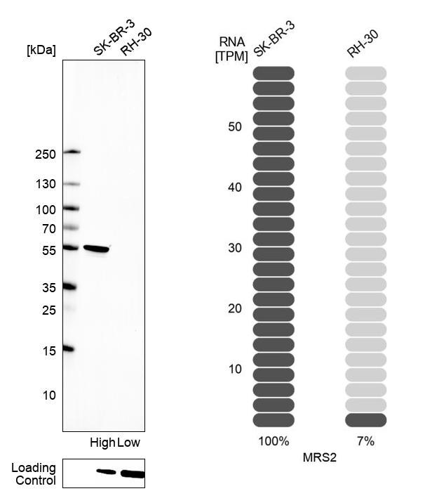 Rabbit Polyclonal Anti-MRS2 Antibody - Buy for research - Highly ...