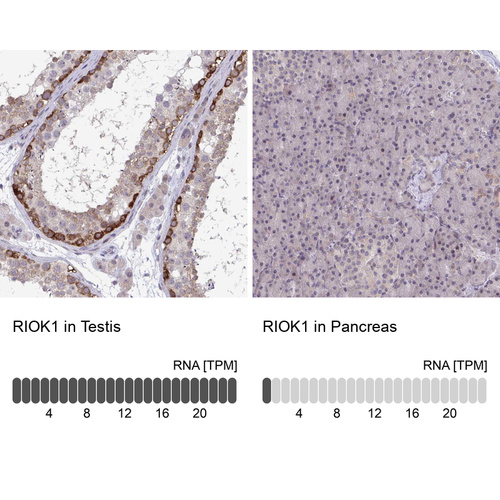 Rabbit Polyclonal Anti-RIOK1 Antibody - Buy for research - Highly ...