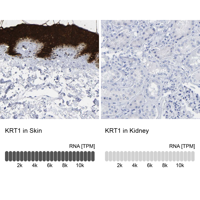 Rabbit Polyclonal Anti-KRT1 Antibody - Buy for research - Highly ...