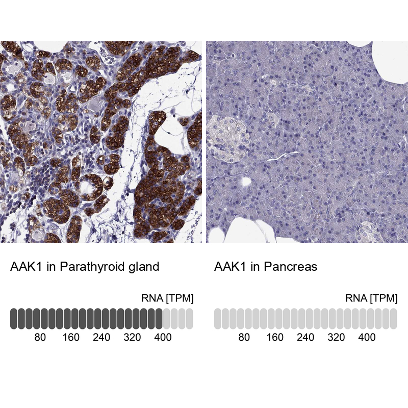 Rabbit Polyclonal Anti-AAK1 Antibody - Buy for research - Highly ...