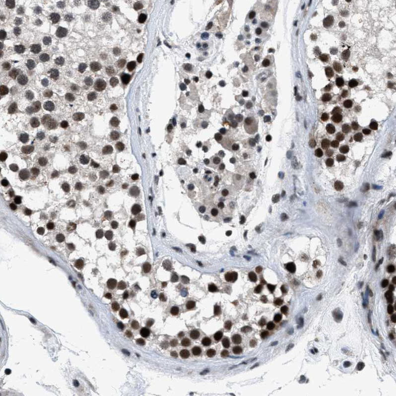 Rabbit Polyclonal Anti-SMARCB1 Antibody - Buy for research - Highly ...