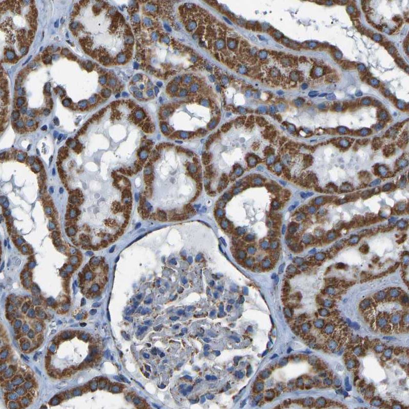 Rabbit Polyclonal Anti-IRX6 Antibody - Buy for research - Highly ...