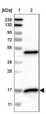 Rabbit Polyclonal Anti-RPS14 Antibody - Buy for research - Highly ...