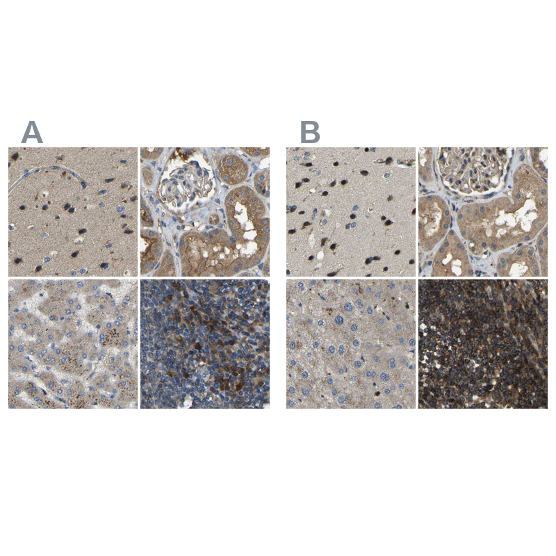 Rabbit Polyclonal Anti-ATP8B1 Antibody - Buy for research - Highly ...