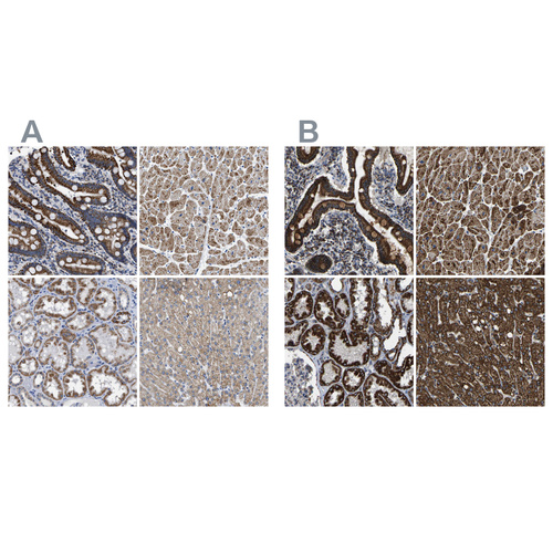 Rabbit Polyclonal Anti-ETFA Antibody - Buy for research - Highly ...