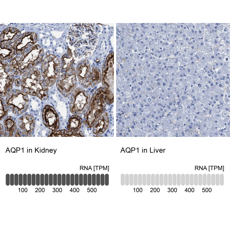 Rabbit Polyclonal Anti-AQP1 Antibody - Buy for research - Highly ...