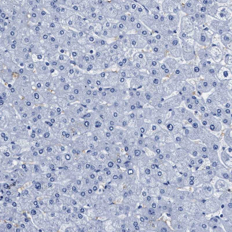Rabbit Polyclonal Anti-AQP1 Antibody - Buy for research - Highly ...