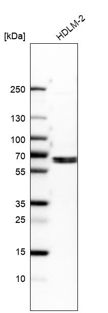 Rabbit Polyclonal Anti-EOGT Antibody - Buy for research - Highly ...