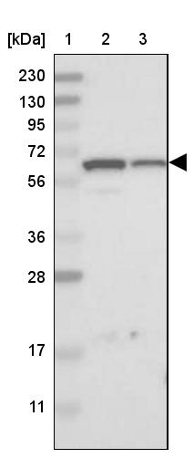 Rabbit Polyclonal Anti-EOGT Antibody - Buy for research - Highly ...