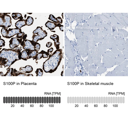Anti-S100P Human Protein Atlas Antibody