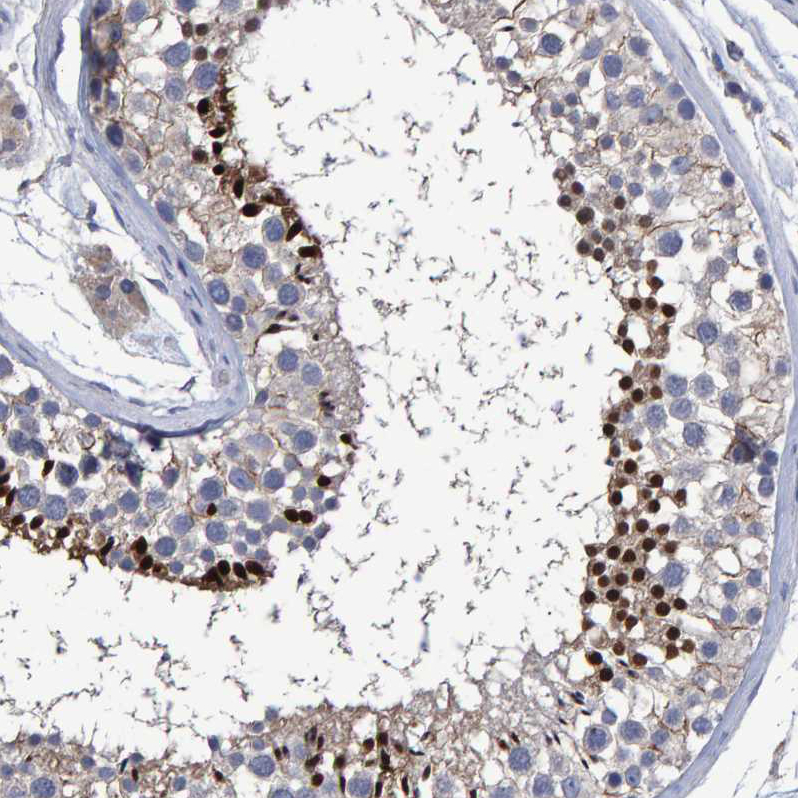 Rabbit Polyclonal Anti-HEMGN Antibody - Buy for research - Highly ...