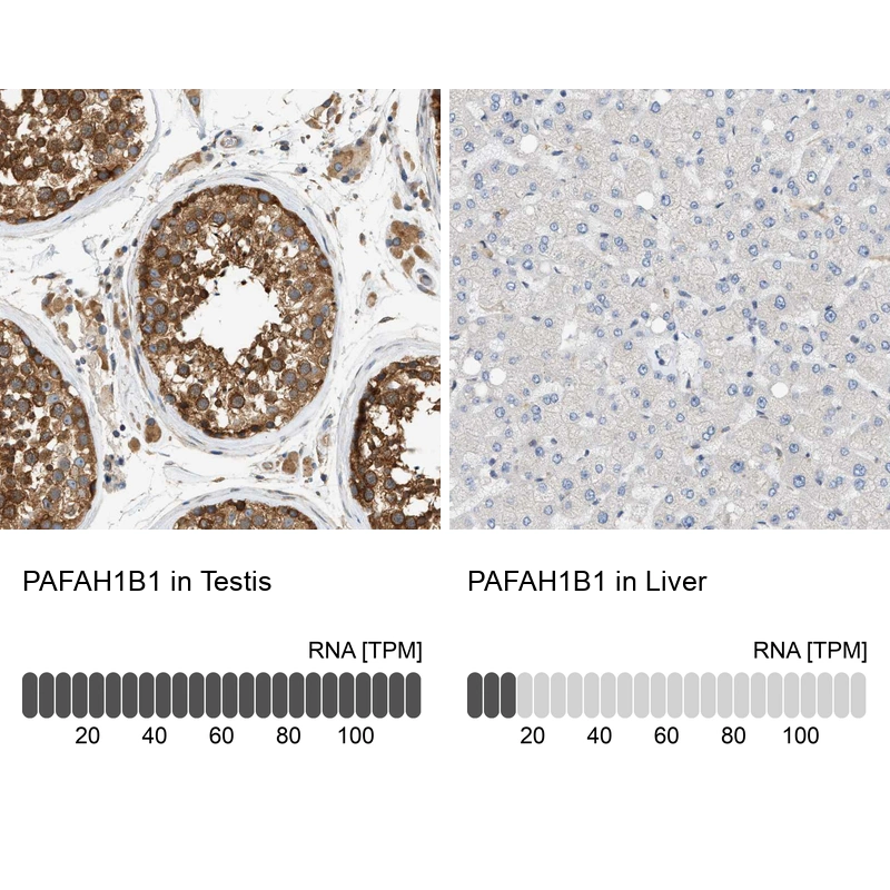 Rabbit Polyclonal Anti-PAFAH1B1 Antibody - Buy for research - Highly ...