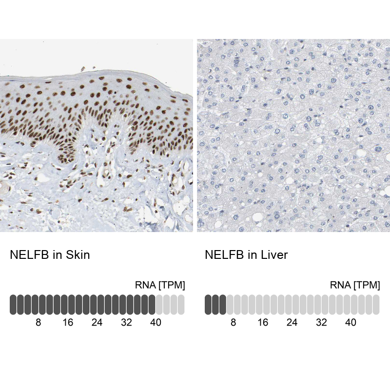 Rabbit Polyclonal Anti-NELFB Antibody - Buy for research - Highly ...