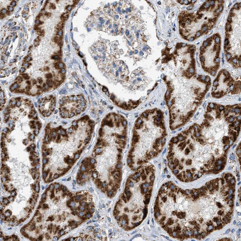 Rabbit Polyclonal Anti-OGDH Antibody - Buy for research - Highly ...