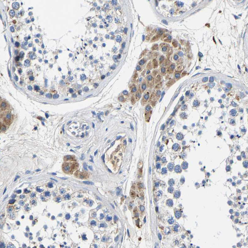Rabbit Polyclonal Anti-SLC25A25 Antibody - Buy for research - Highly ...