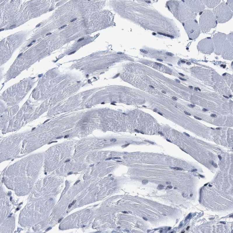 Rabbit Polyclonal Anti-INIP Antibody - Buy for research - Highly ...