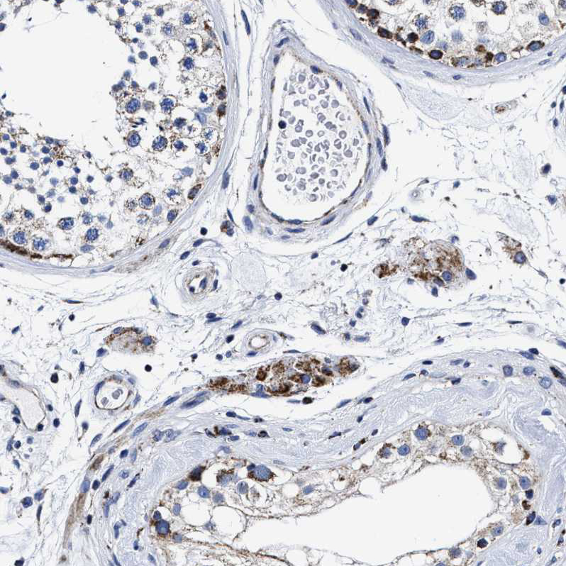 Rabbit Polyclonal Anti-HINT2 Antibody - Buy for research - Highly ...