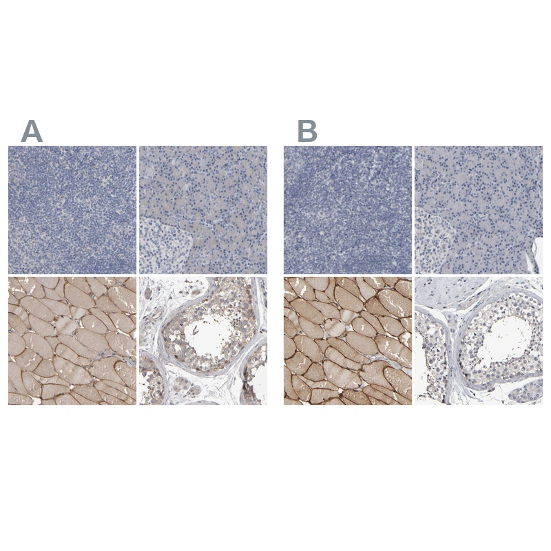 Rabbit Polyclonal Anti-MURC Antibody - Buy for research - Highly ...