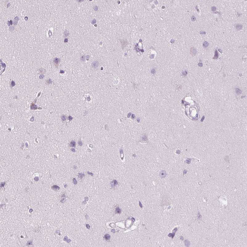 Rabbit Polyclonal Anti-MPO Antibody - Buy for research - Highly ...