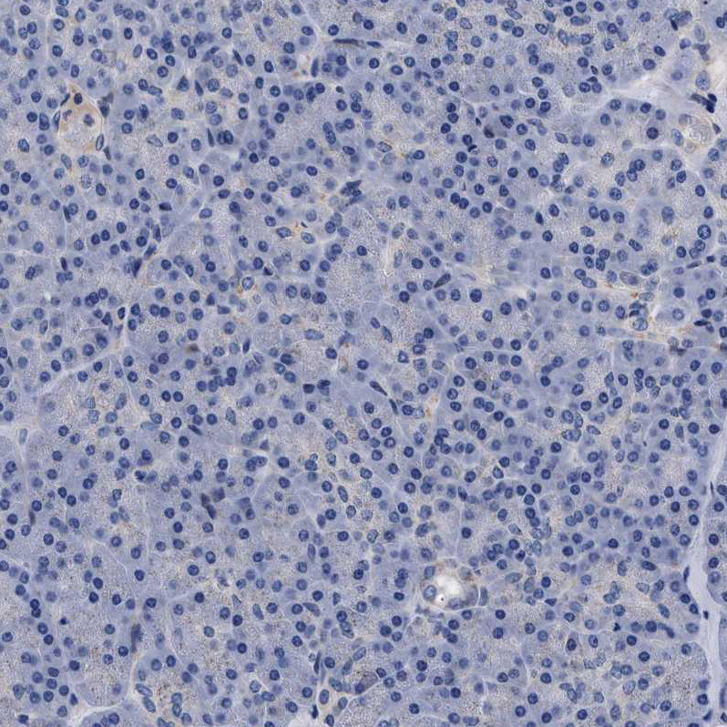 Rabbit Polyclonal Anti-ACOX1 Antibody - Buy for research - Highly ...