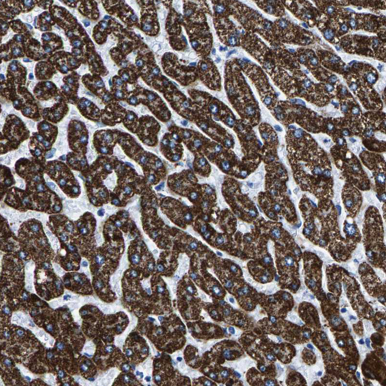 Rabbit Polyclonal Anti-CPS1 Antibody - Buy for research - Highly ...