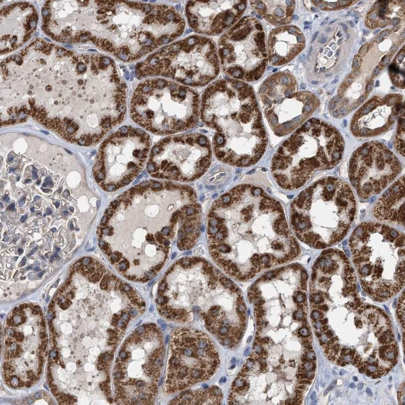Rabbit Polyclonal Anti-EXOSC2 Antibody - Buy for research - Highly ...