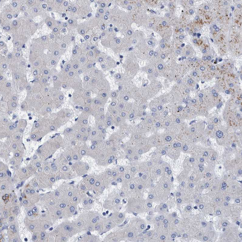 Rabbit Polyclonal Anti-MKS1 Antibody - Buy for research - Highly ...