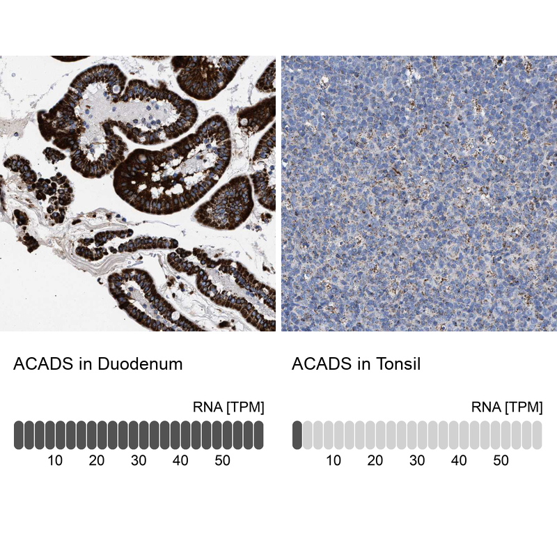 Rabbit Polyclonal Anti-ACADS Antibody - Buy for research - Highly specific, rigorously validated ...