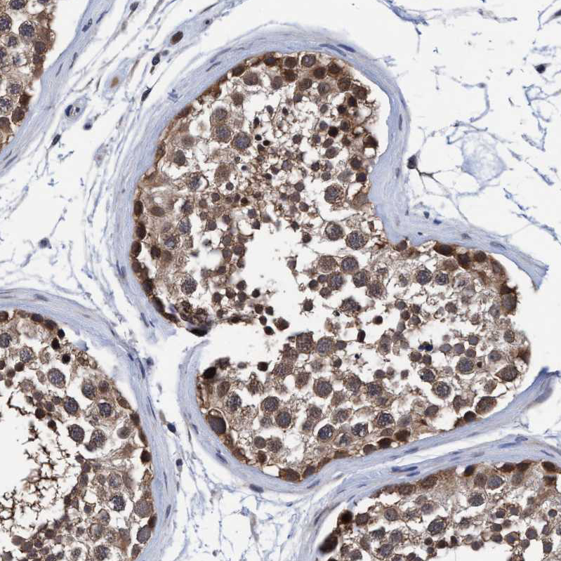 Rabbit Polyclonal Anti-PSMD12 Antibody - Buy for research - Highly ...