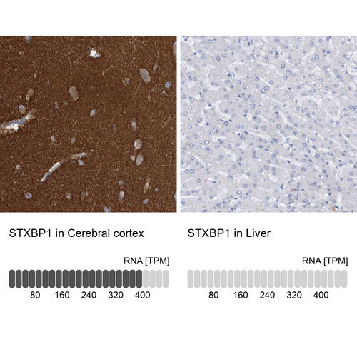 Rabbit Polyclonal Anti-STXBP1 Antibody - Buy for research - Highly specific, rigorously ...