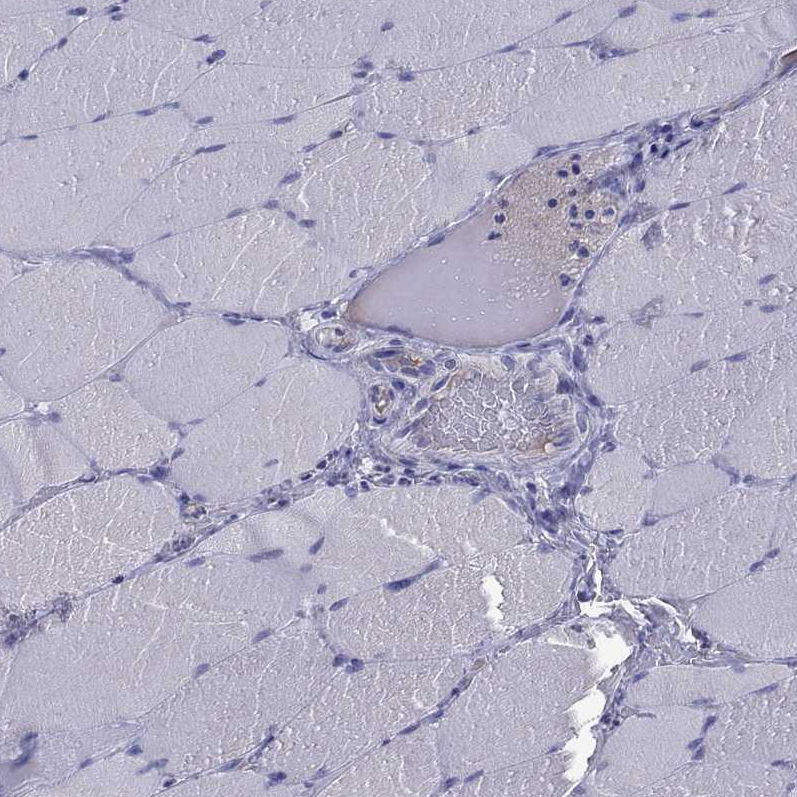 Rabbit Polyclonal Anti-STAR Antibody - Buy for research - Highly ...