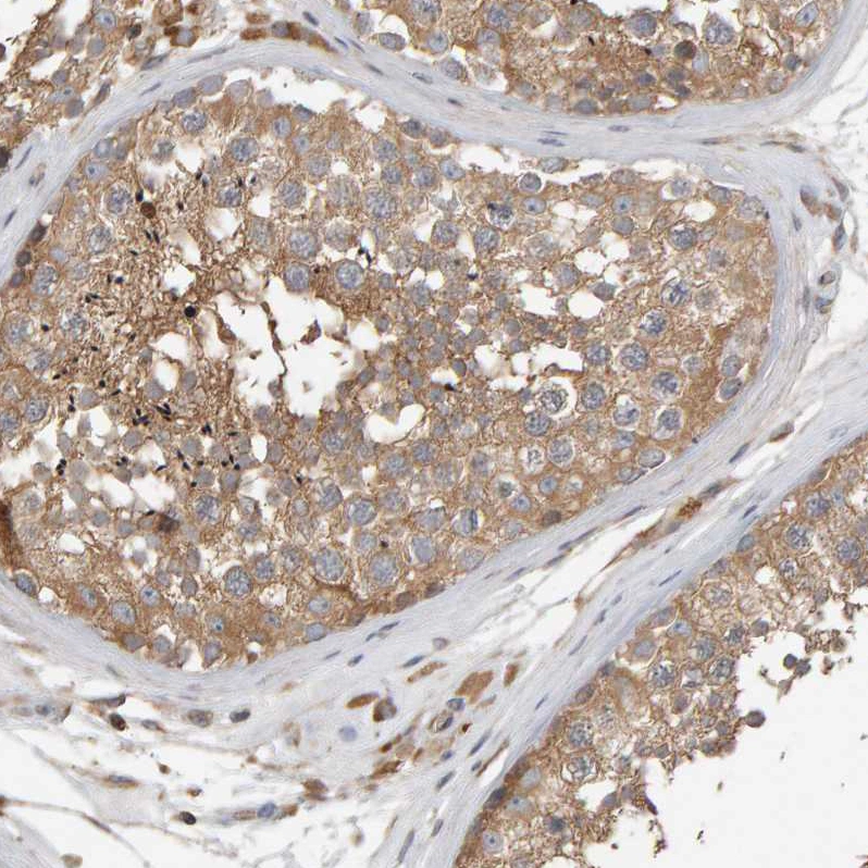Rabbit Polyclonal Anti-C9orf72 Antibody - Buy for research - Highly ...