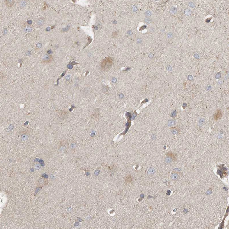 Rabbit Polyclonal Anti-C9orf72 Antibody - Buy for research - Highly ...