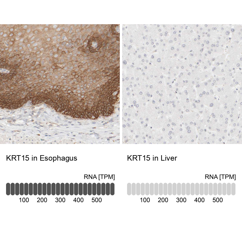 Rabbit Polyclonal Anti-KRT15 Antibody - Buy for research - Highly ...