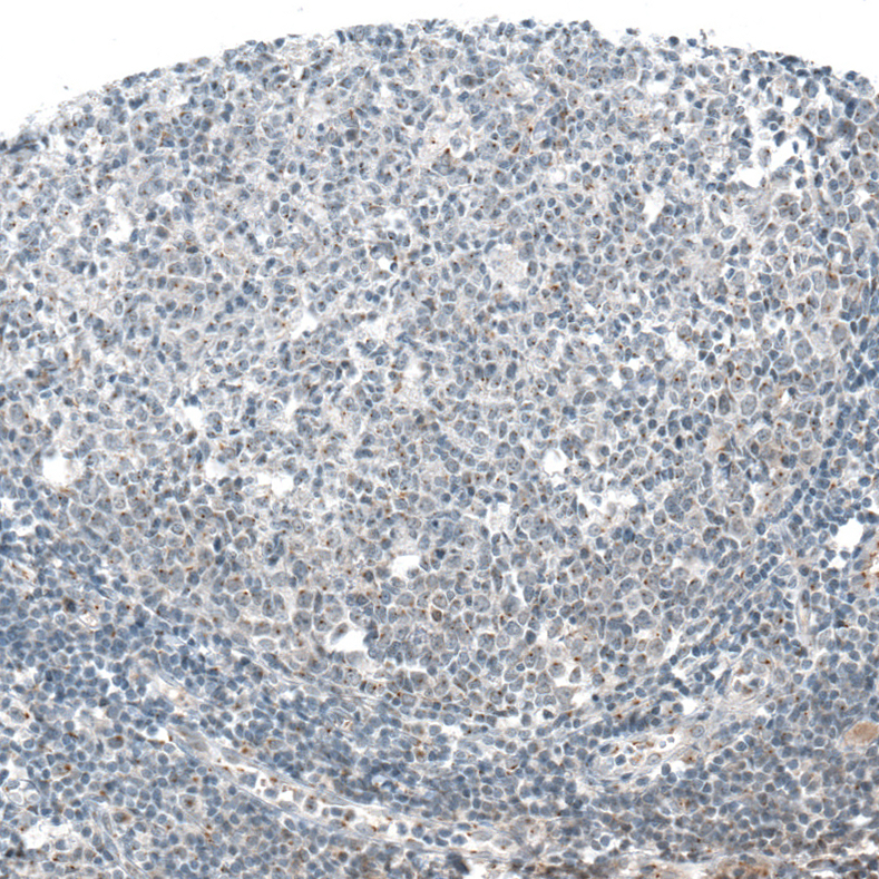 Rabbit Polyclonal Anti-CEP131 Antibody - Buy for research - Highly ...