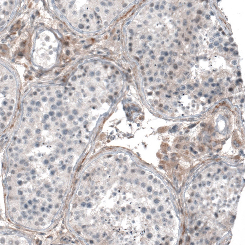Rabbit Polyclonal Anti-CHRM3 Antibody - Buy for research - Highly ...