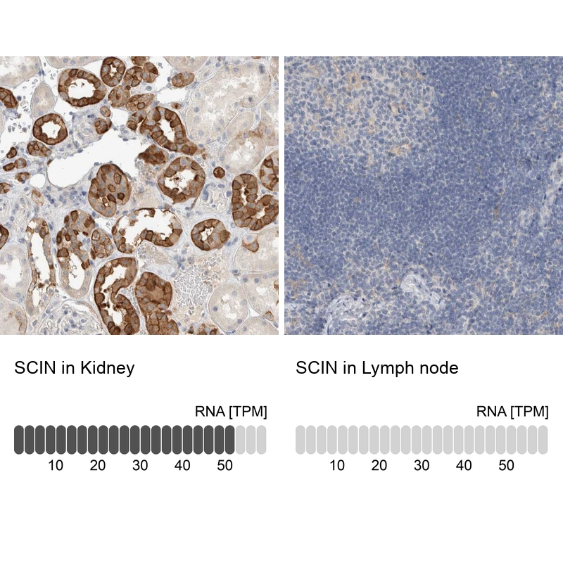 Rabbit Polyclonal Anti-SCIN Antibody - Buy for research - Highly ...