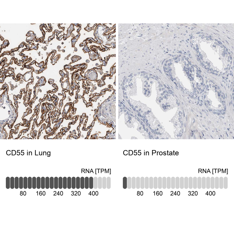 Rabbit Polyclonal Anti-CD55 Antibody - Buy for research - Highly specific, rigorously validated ...