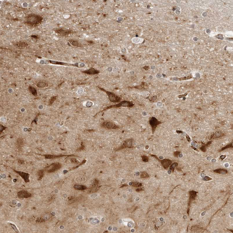 Rabbit Polyclonal Anti-STXBP3 Antibody - Buy for research - Highly ...