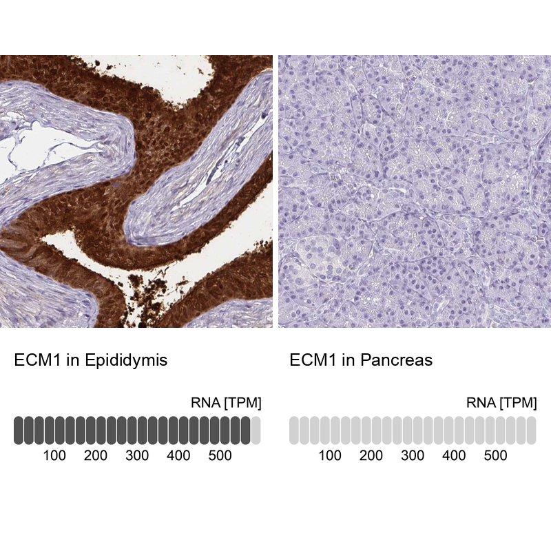 Rabbit Polyclonal Anti-ECM1 Antibody - Buy for research - Highly ...